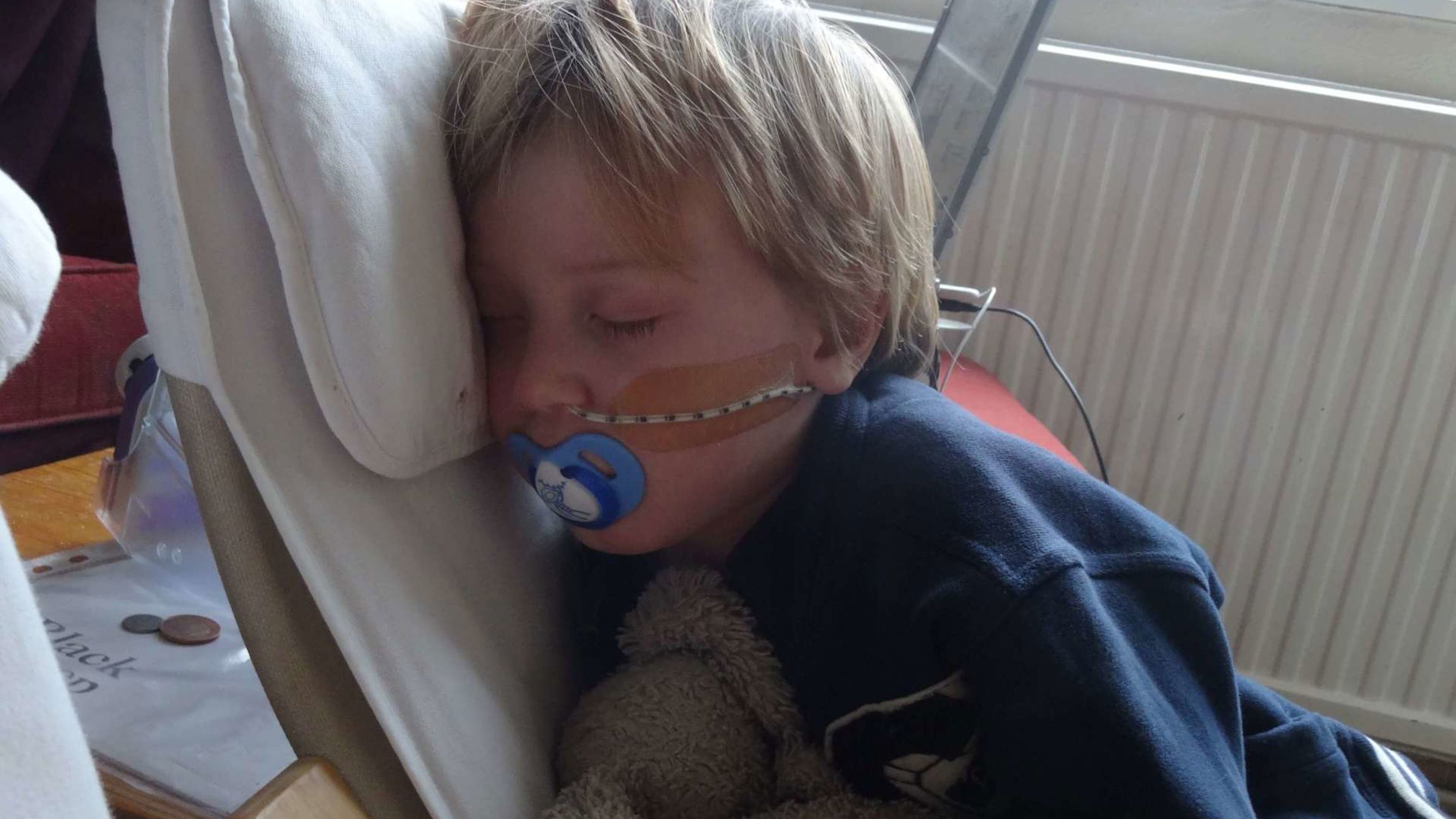 very early onset IBD